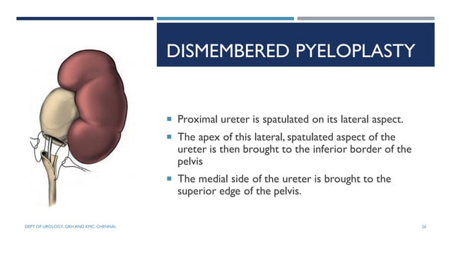 Pediatric urology pujo- pyeloplasty | PDF | Surgery | Medical Health