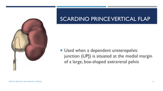 Pediatric urology pujo- pyeloplasty | PDF
