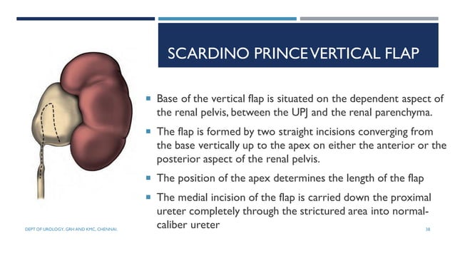 Pediatric urology pujo- pyeloplasty | PDF | Surgery | Medical Health