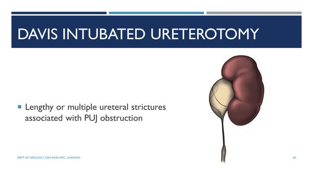 Pediatric urology pujo- pyeloplasty | PDF | Surgery | Medical Health