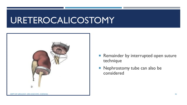 Pediatric urology pujo- pyeloplasty | PDF | Surgery | Medical Health