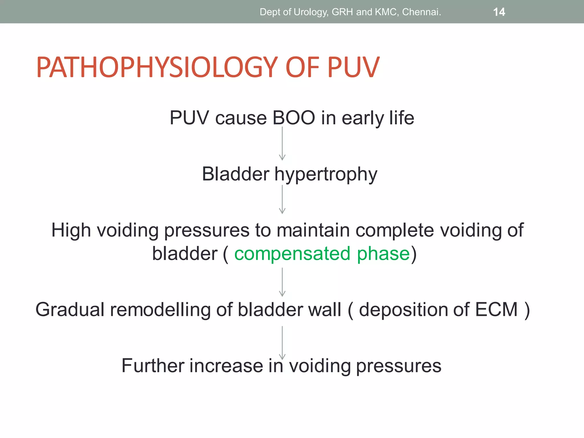 Pediatric urology :Posterior Urethral Valve (PUV)- diagnosis ...