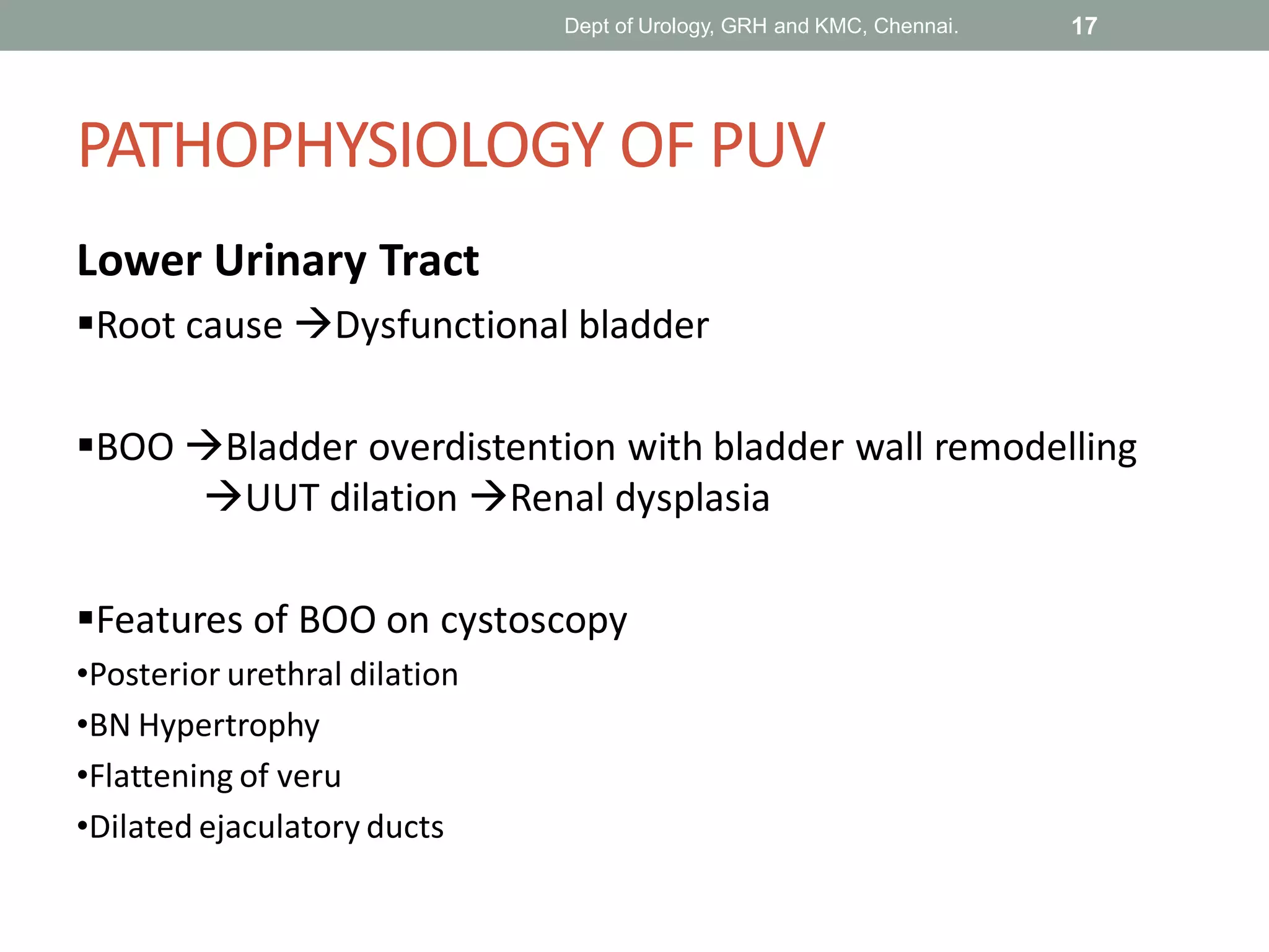 Pediatric urology :Posterior Urethral Valve (PUV)- diagnosis ...