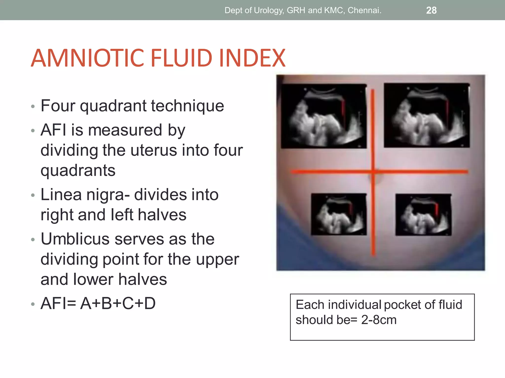 Pediatric urology :Posterior Urethral Valve (PUV)- diagnosis ...