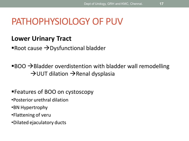 Pediatric urology :Posterior Urethral Valve (PUV)- diagnosis ...