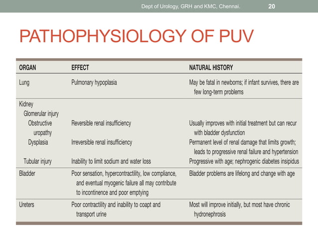 Pediatric urology :Posterior Urethral Valve (PUV)- diagnosis ...