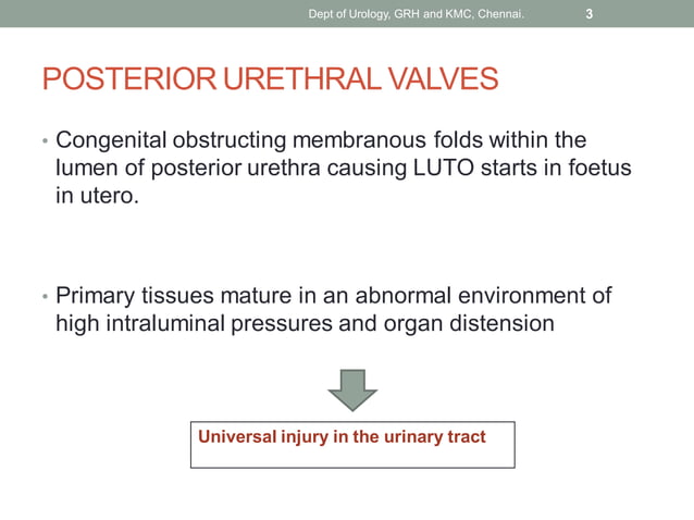 Pediatric urology :Posterior Urethral Valve (PUV)- diagnosis ...