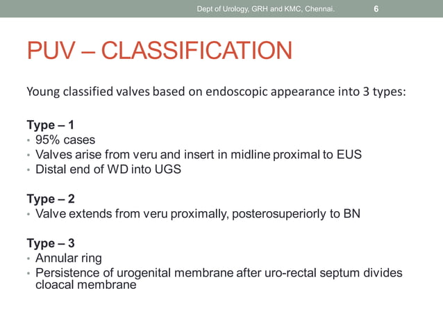 Pediatric urology :Posterior Urethral Valve (PUV)- diagnosis ...