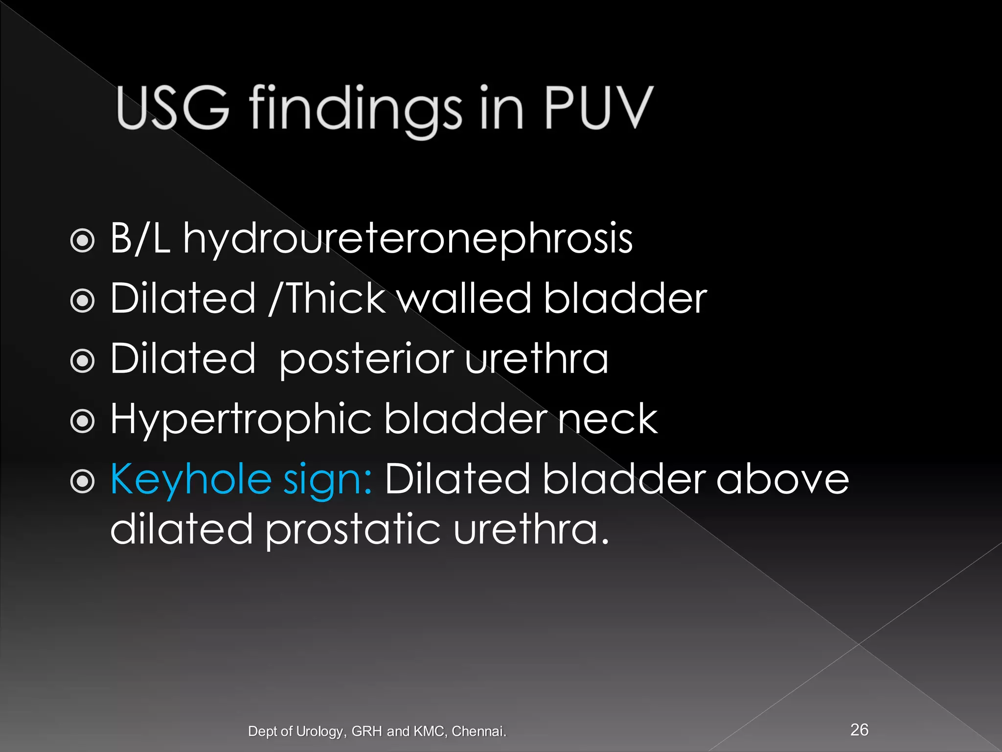Pediatric urology : PUV- overview | PDF