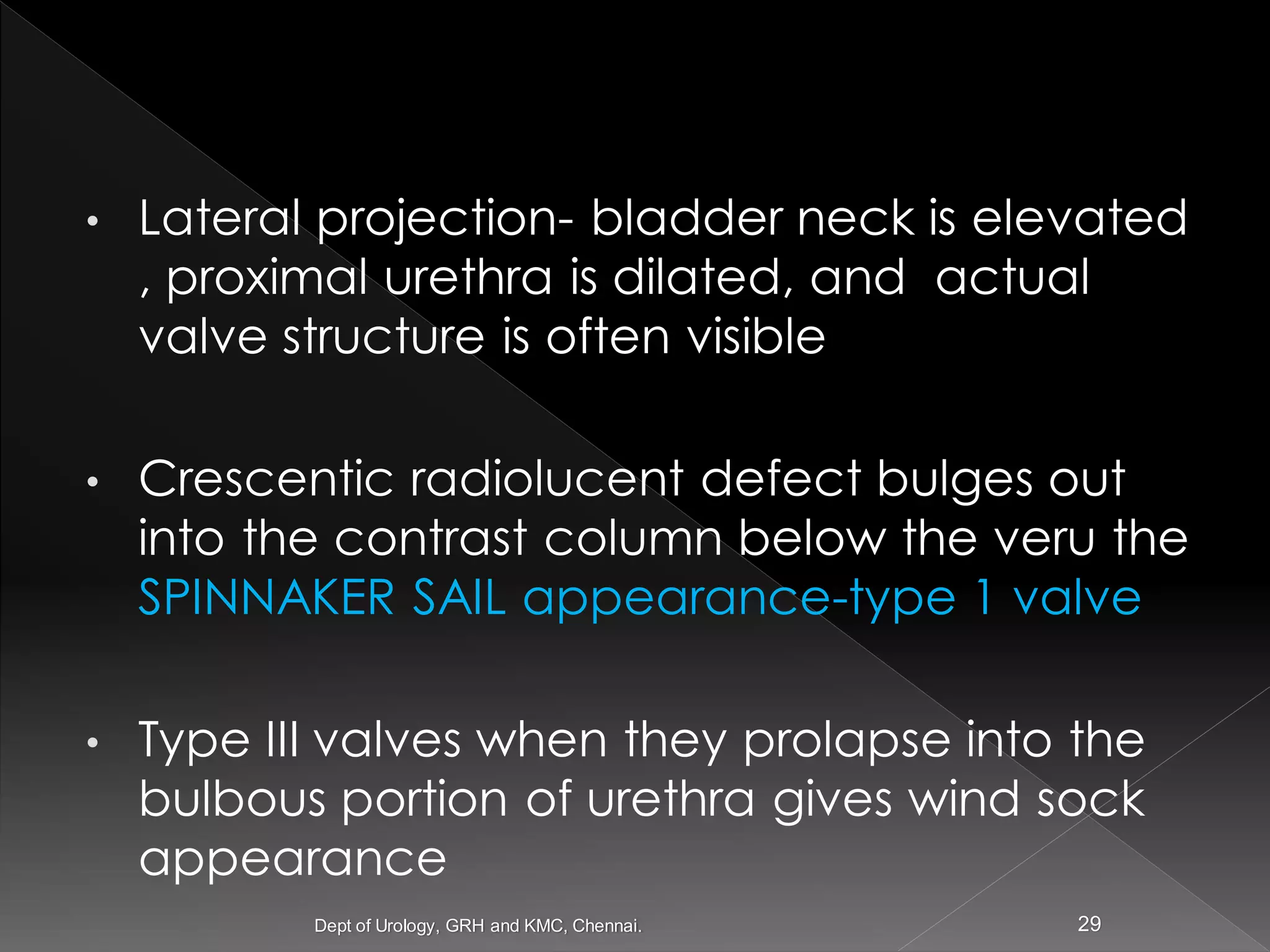 Pediatric urology : PUV- overview | PDF