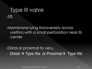 Pediatric urology : PUV- overview | PDF