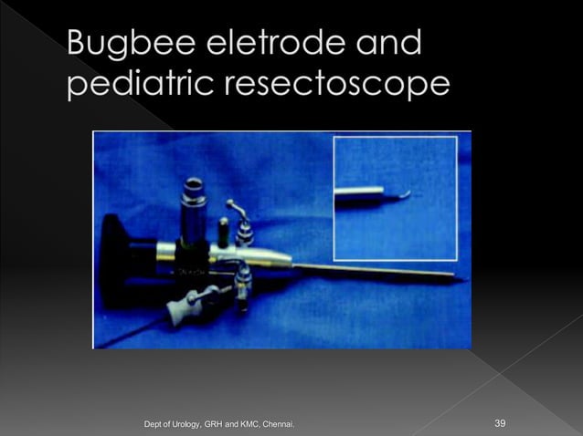 Pediatric urology : PUV- overview | PDF