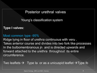Pediatric urology : PUV- overview | PDF