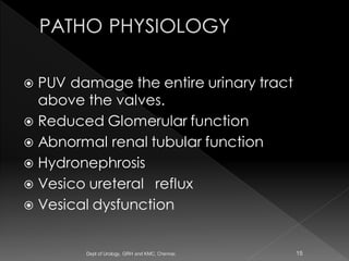 Pediatric urology : PUV- overview | PPT