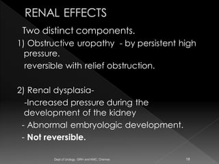 Pediatric urology : PUV- overview | PPT