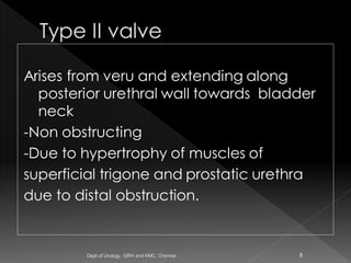 Pediatric urology : PUV- overview | PPT