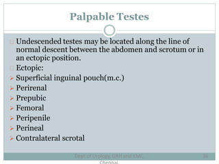 Pediatric urology :Undescended Testis (UDT) | PDF