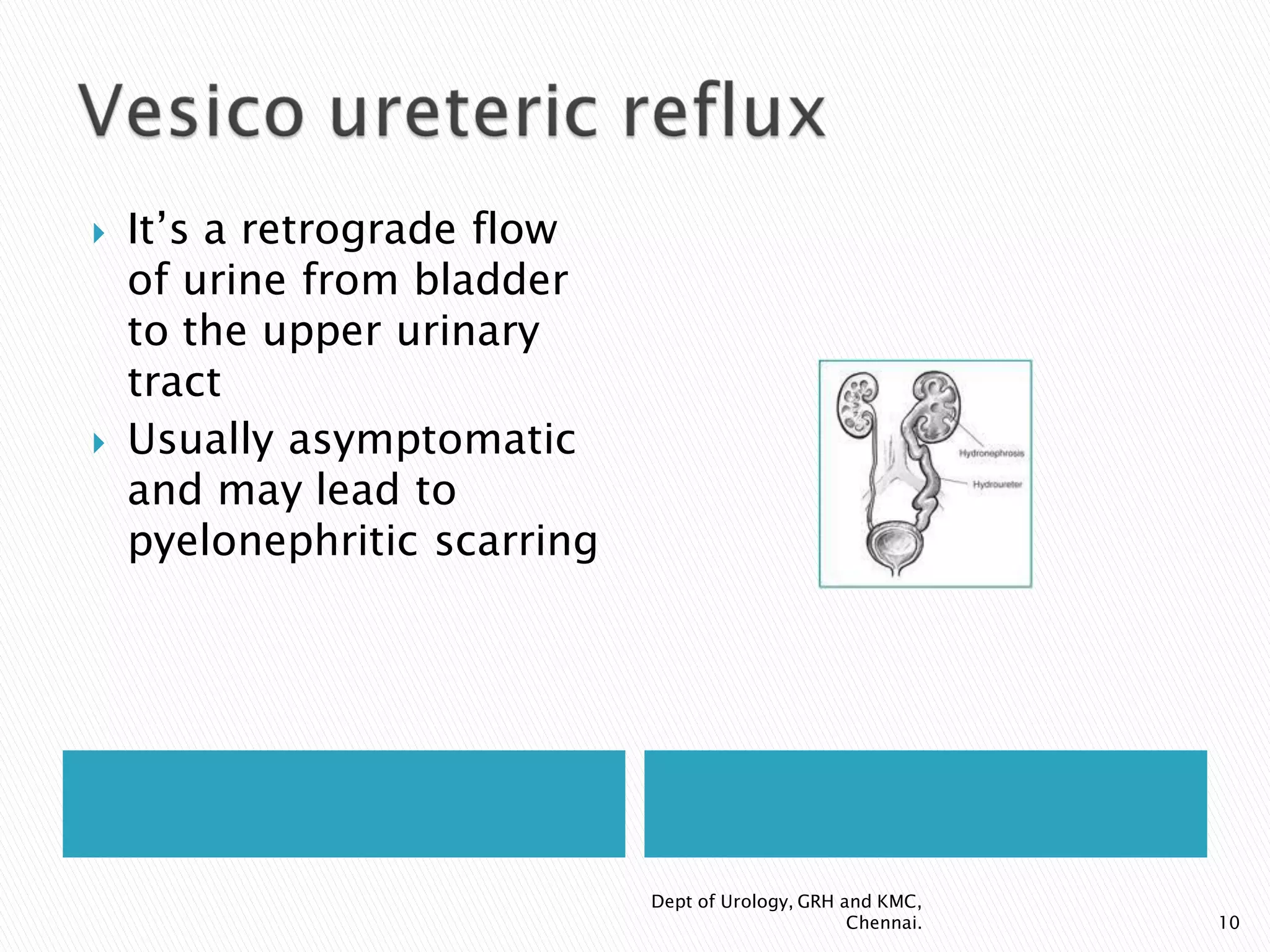 Pediatric urology : Vesicoureteric reflux(vur)- overview | PDF ...