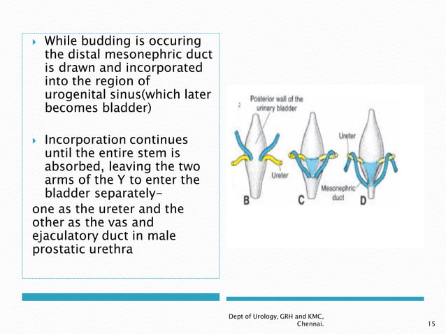 Pediatric urology : Vesicoureteric reflux(vur)- overview | PDF ...