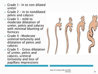 Pediatric urology : Vesicoureteric reflux(vur)- overview | PDF
