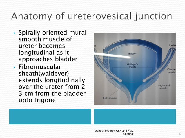 Pediatric urology : Vesicoureteric reflux(vur)- overview | PDF ...