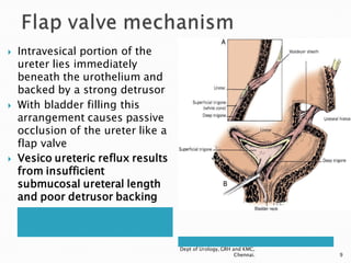 Pediatric urology : Vesicoureteric reflux(vur)- overview | PDF