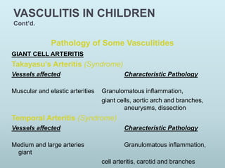 Pediatric vasculitis dr inayat ullah | PPTX