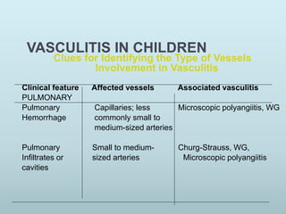 Pediatric vasculitis dr inayat ullah | PPTX