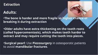 Pediatric vs. Adult Dental Anesthesia & Extractions.pptx
