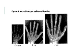 Features of Skeletal System in Children | PPTX