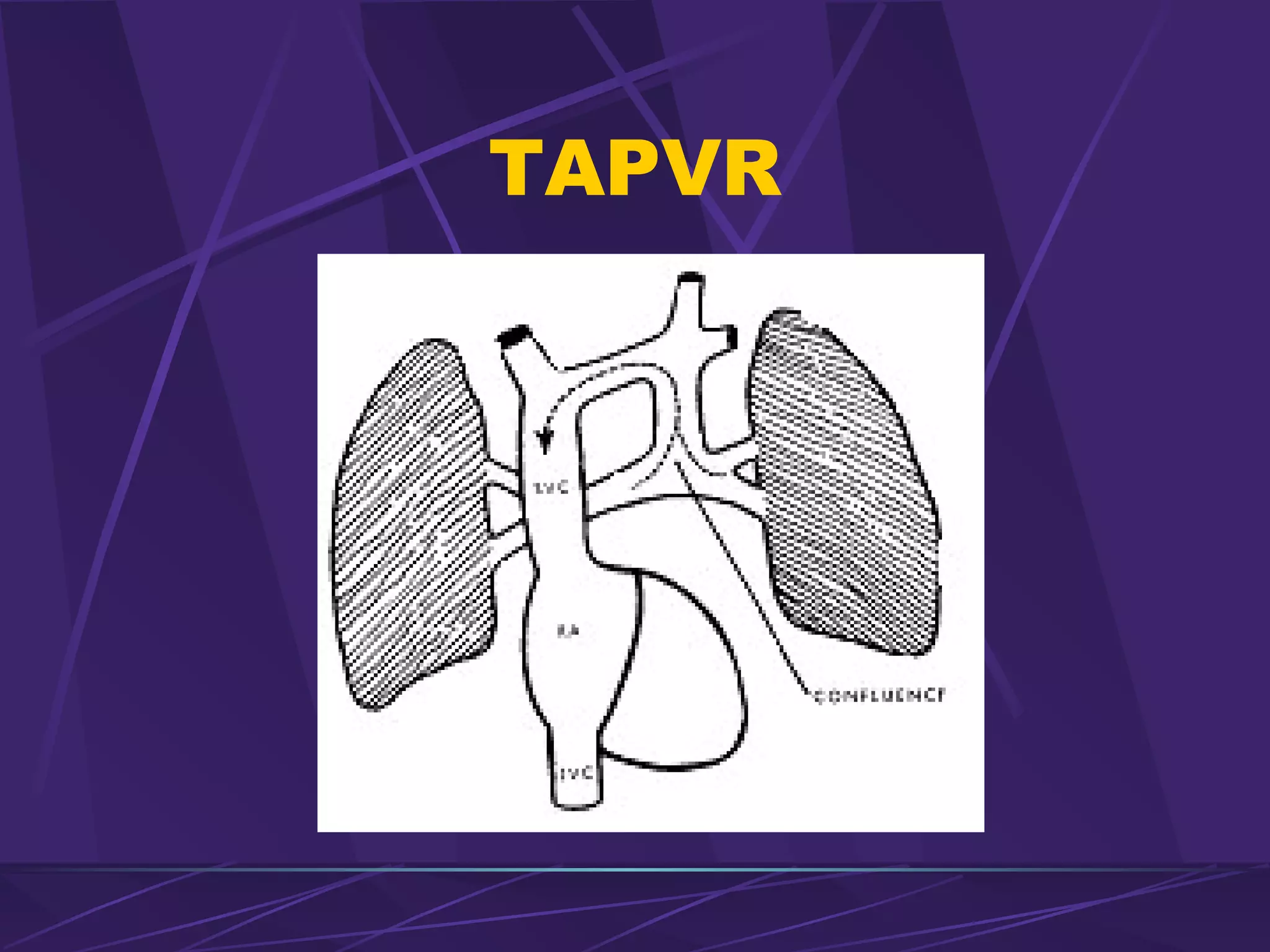 Pediatric Cardiology Emergencies | PPT