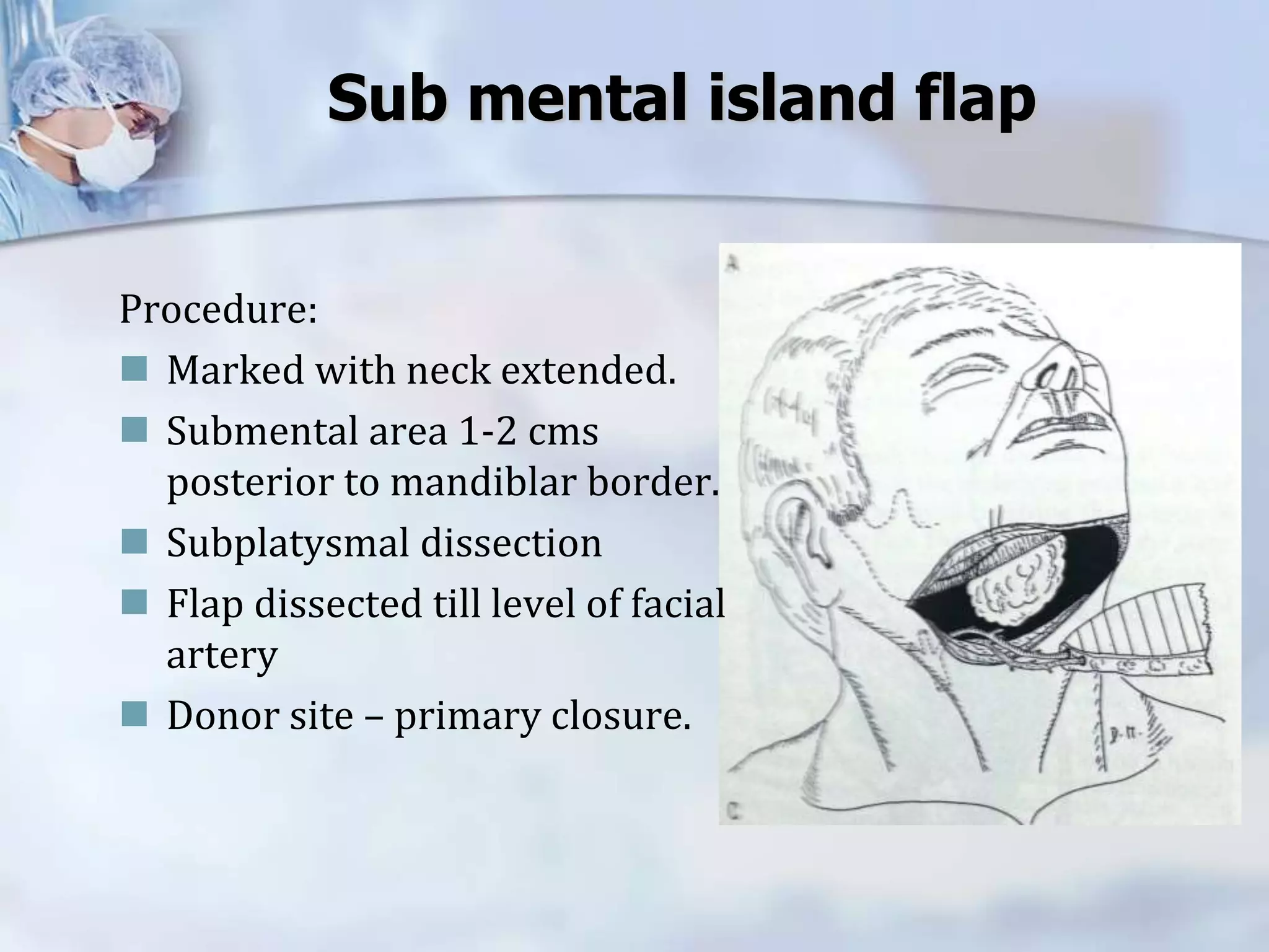 scope of Pedicled flaps in oral and maxillofacial surgery | PPTX