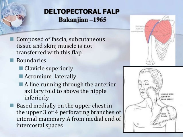 scope of Pedicled flaps in oral and maxillofacial surgery