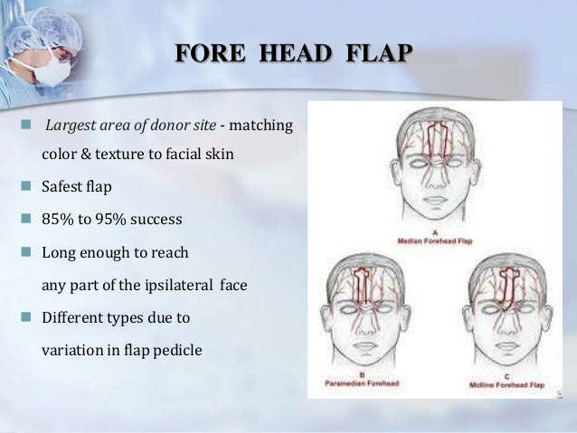 scope of Pedicled flaps in oral and maxillofacial surgery