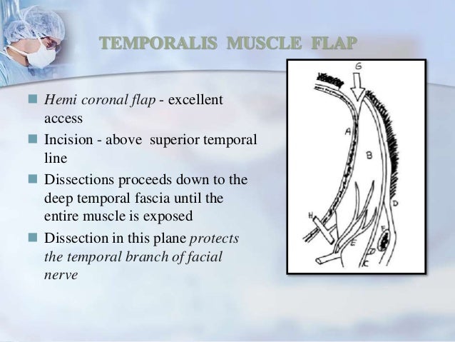 scope of Pedicled flaps in oral and maxillofacial surgery