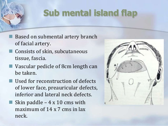 scope of Pedicled flaps in oral and maxillofacial surgery
