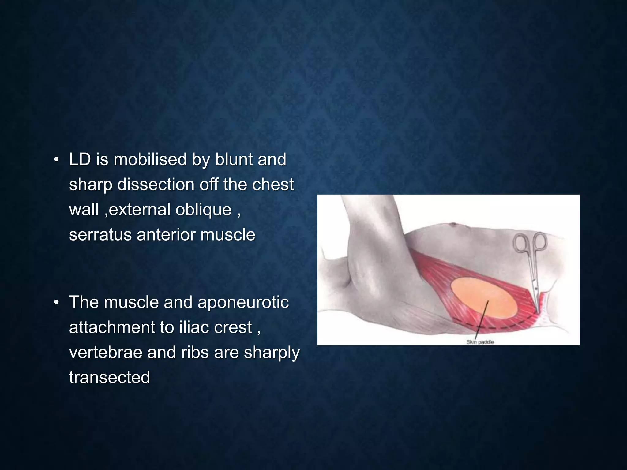 Pedicled flaps in head and neck surgery | PPTX