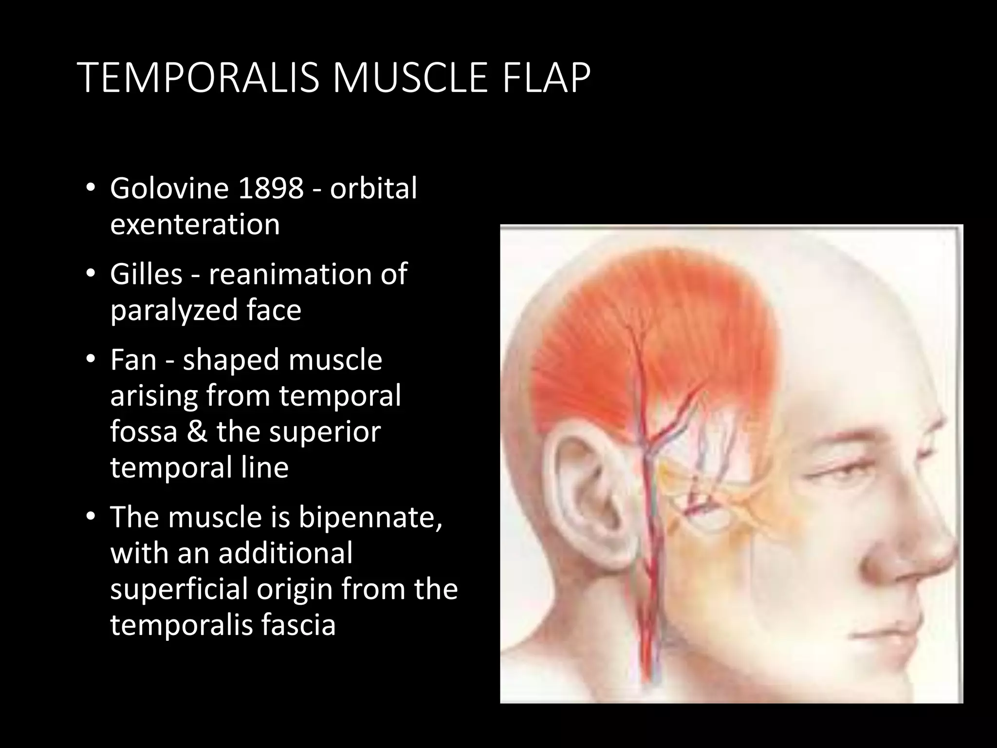 Pedicle flap in Maxillofacial Surgery | PPTX