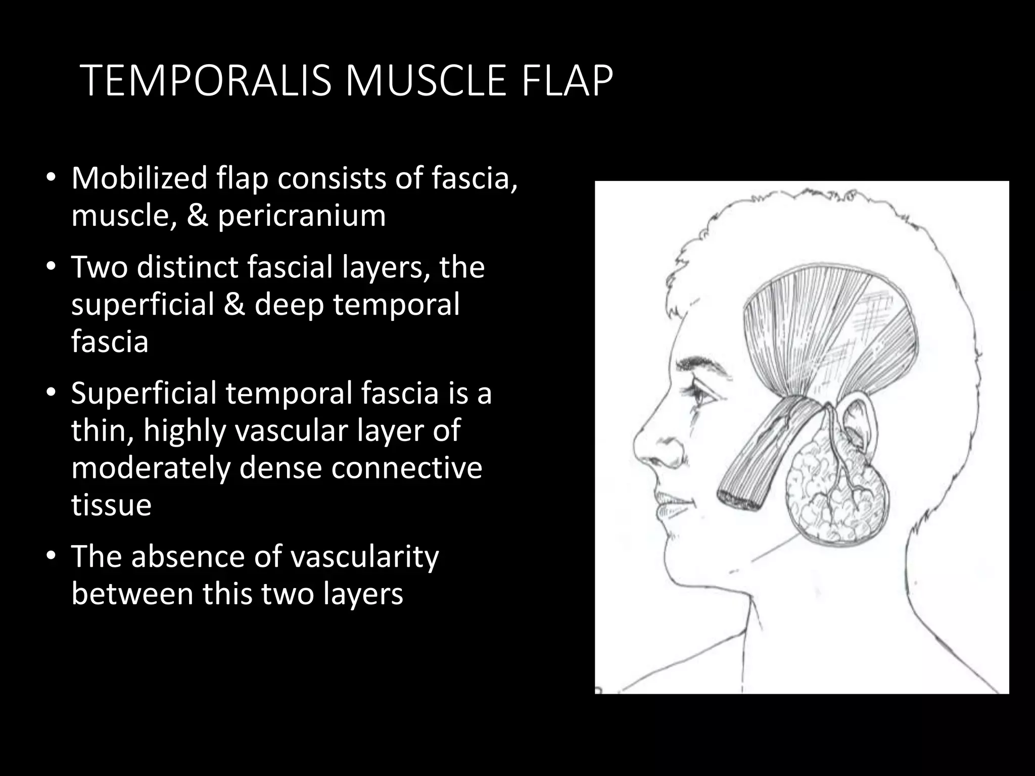 Pedicle flap in Maxillofacial Surgery | PPTX