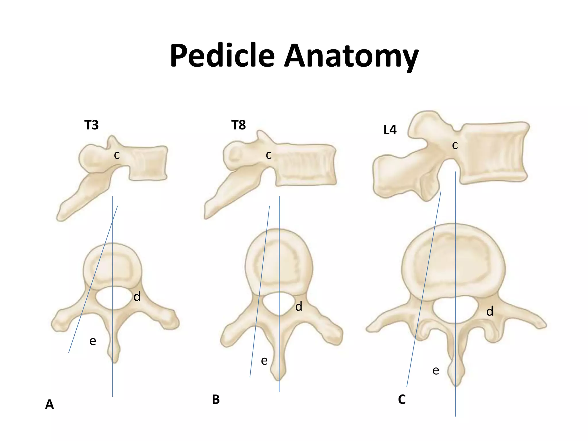 Pedicle screw by professor shah alam | PPTX