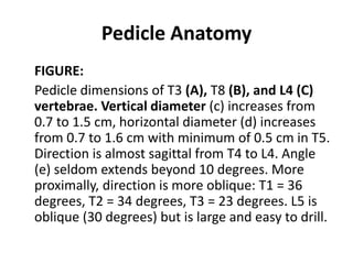 Pedicle screw by professor shah alam | PPTX