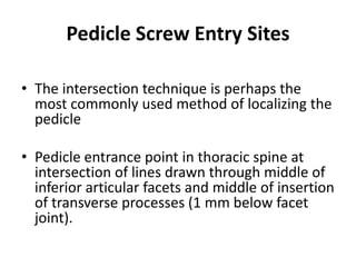 Pedicle screw by professor shah alam | PPTX
