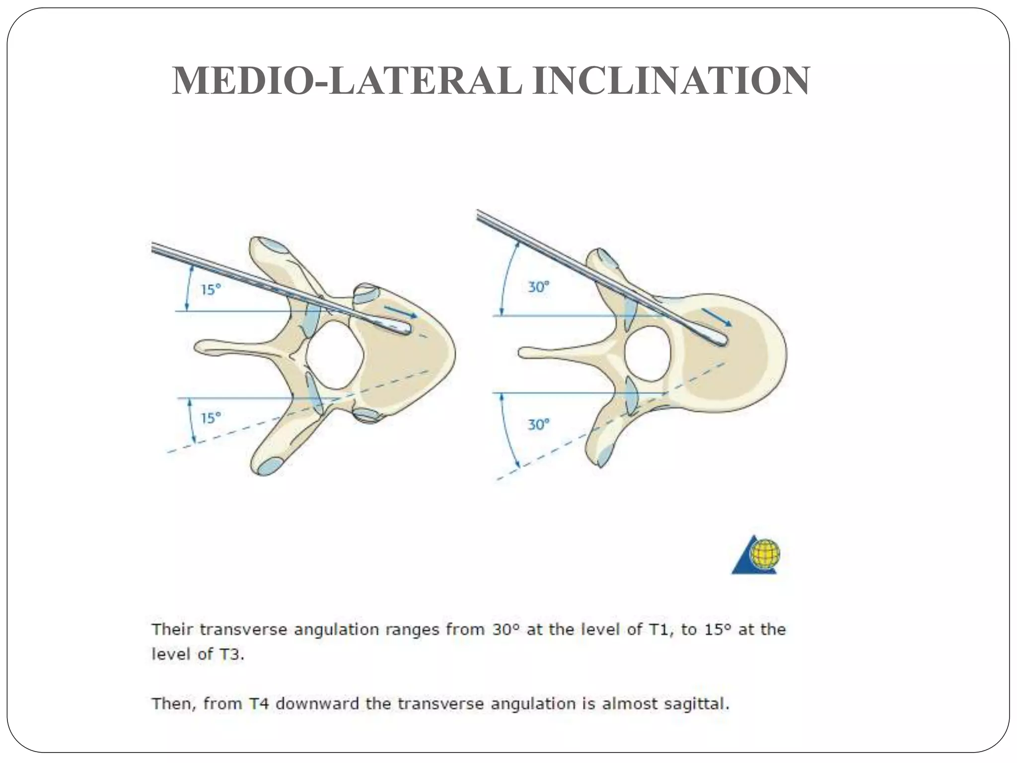 Pedicle Screws Fixation of Thoraco-Lumbar Spine | PPTX