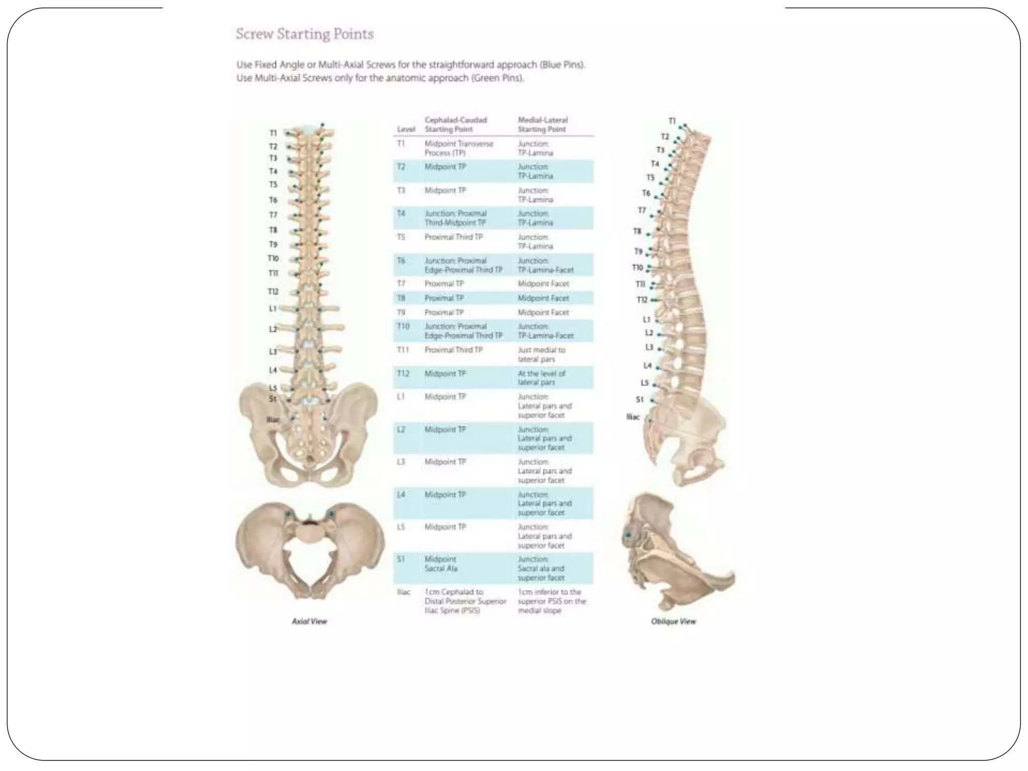 Pedicle Screws Fixation of Thoraco-Lumbar Spine | PPTX