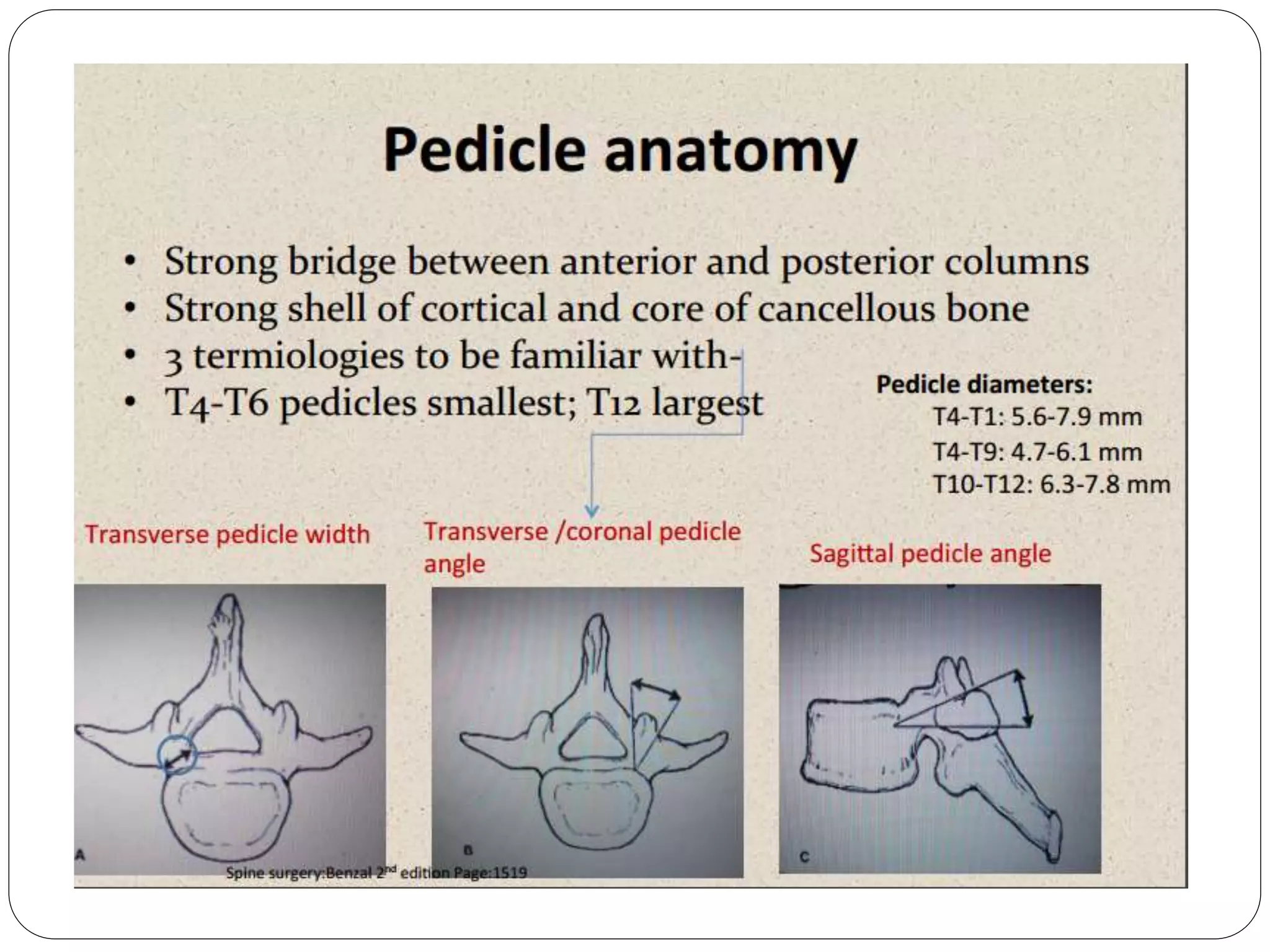 Pedicle Screws Fixation of Thoraco-Lumbar Spine | PPTX