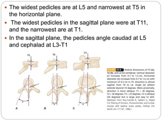 Pedicle Screws Fixation of Thoraco-Lumbar Spine | PPTX