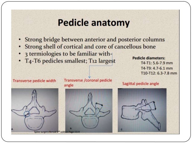 Pedicle Screws Fixation of Thoraco-Lumbar Spine