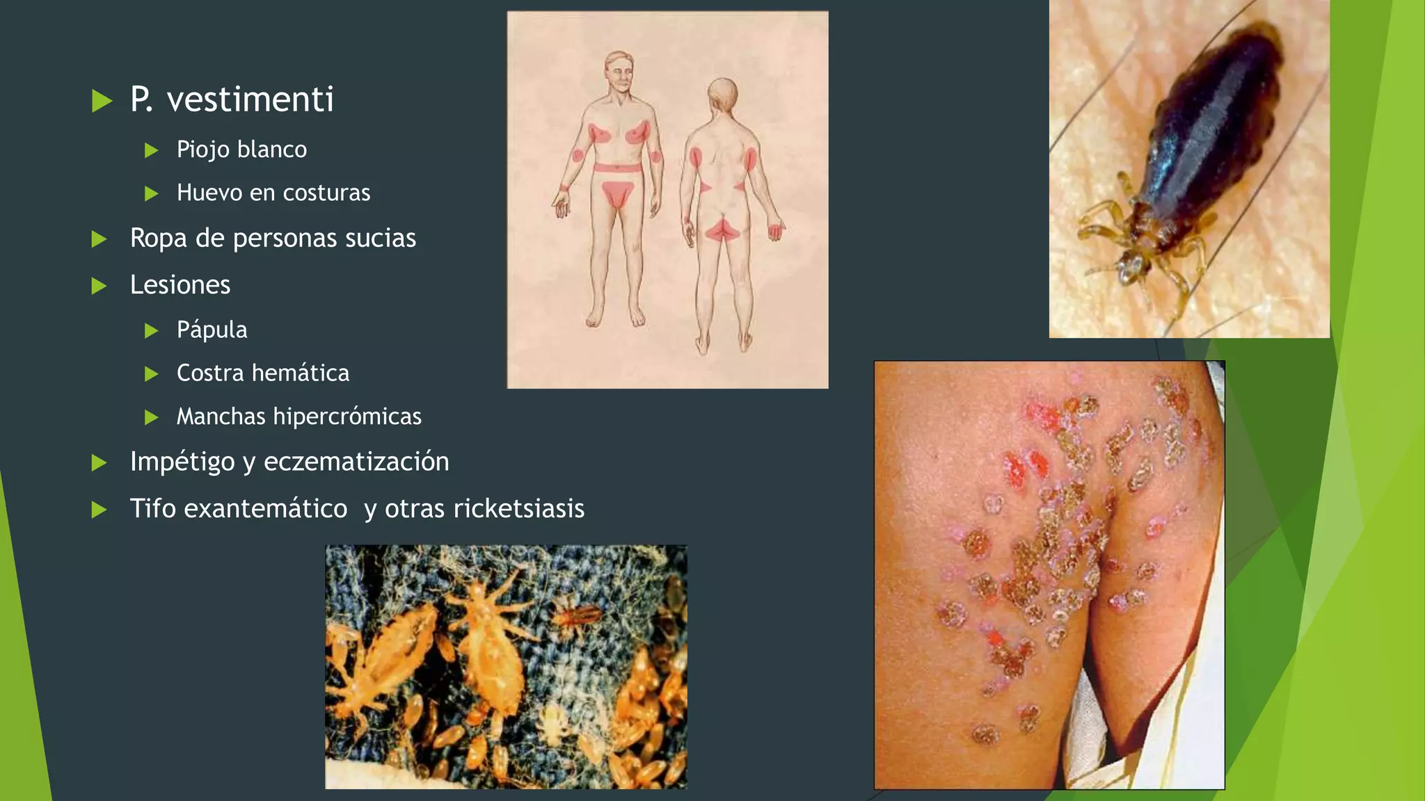Pediculosis | PPT