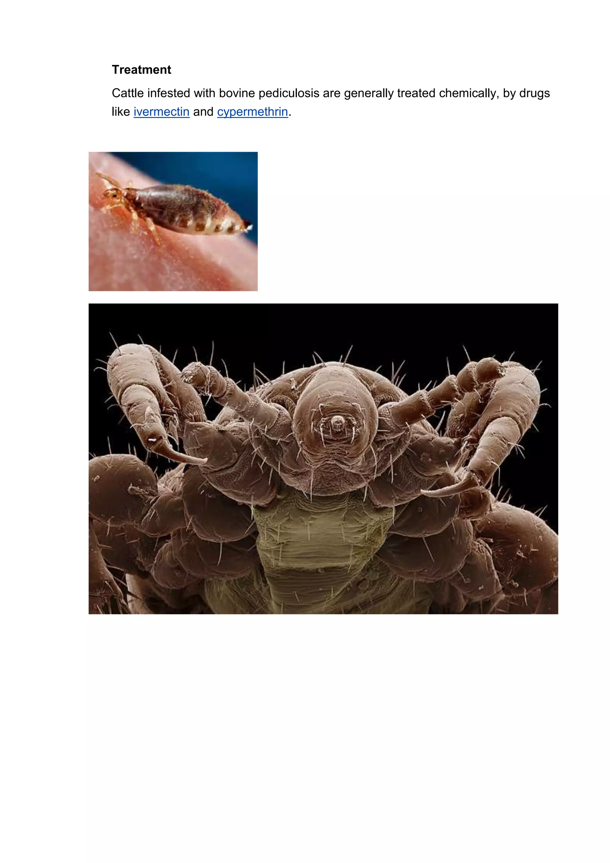 Pediculosis | DOCX