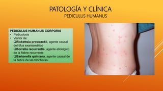 Pediculosis | PPTX
